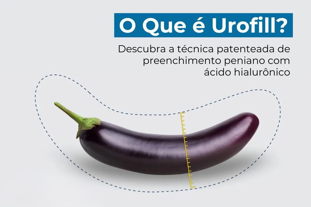 Harmonização Peniana - Aumente e Engrosse Seu Pênis | UROFILL em Maceió ...